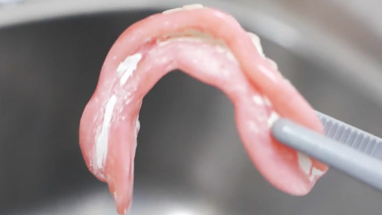 Denture Polishing & Cleaning - Dentures & Implant Solutions | North ...