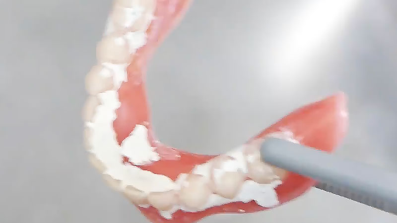 Denture Polishing & Cleaning - Dentures & Implant Solutions | North ...